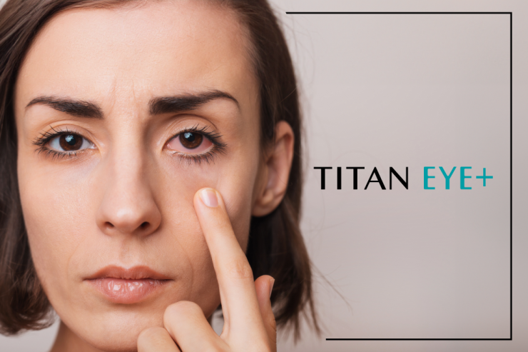 Ultimate Guide to Sunglasses, Eyeglasses & Contact Lenses